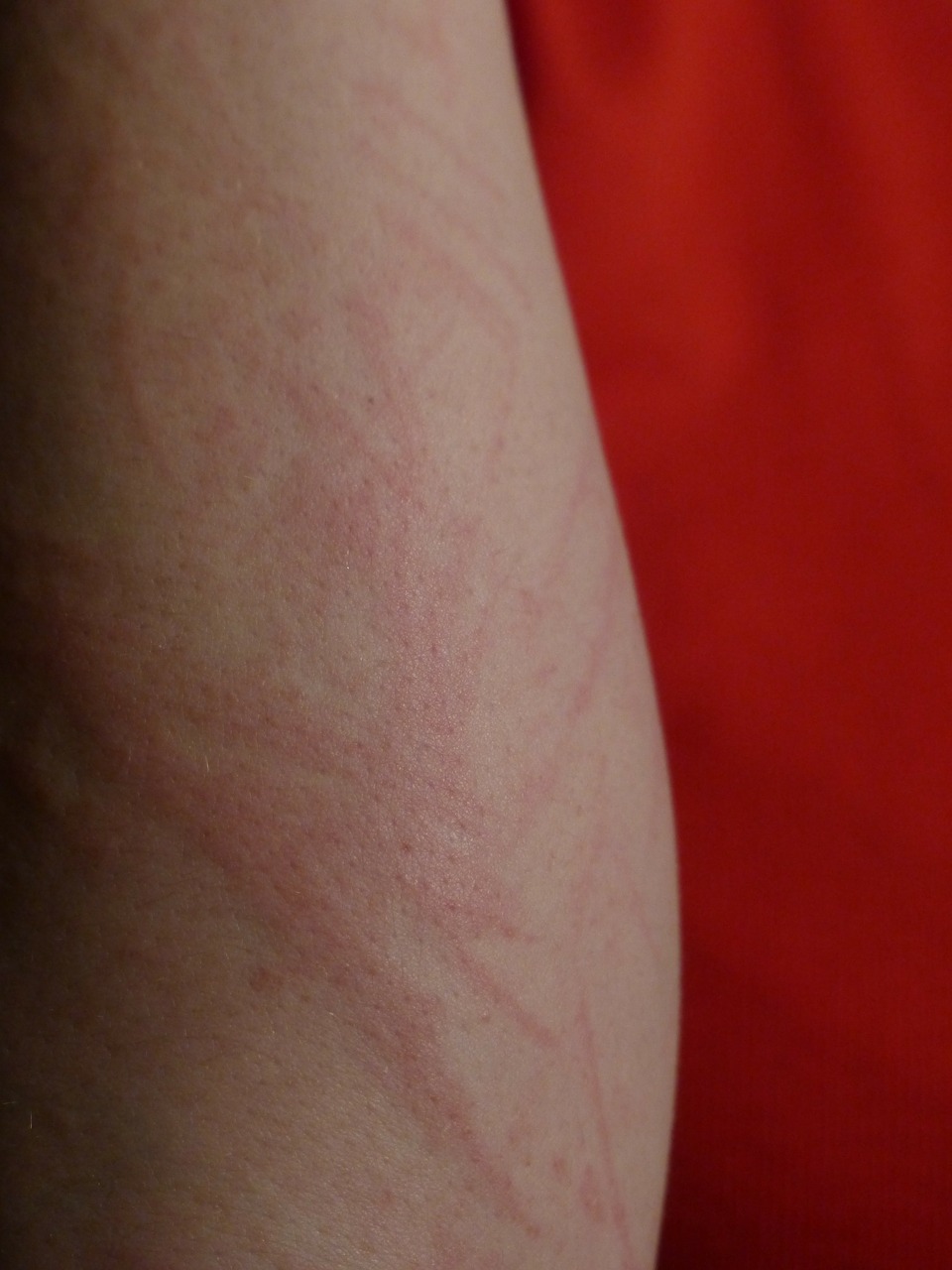 Les irritations : comment lutter contre ? – Maison santé